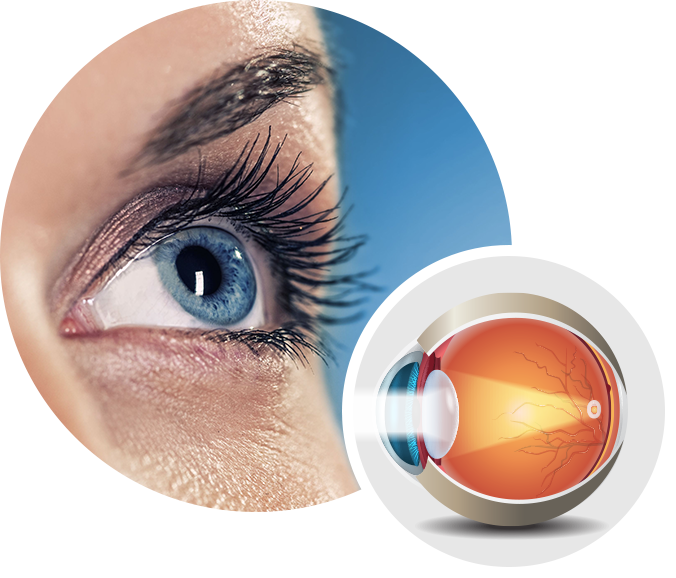 Arrowhead Eye Associates – Physicians and Surgeons of the Eye and Orbit